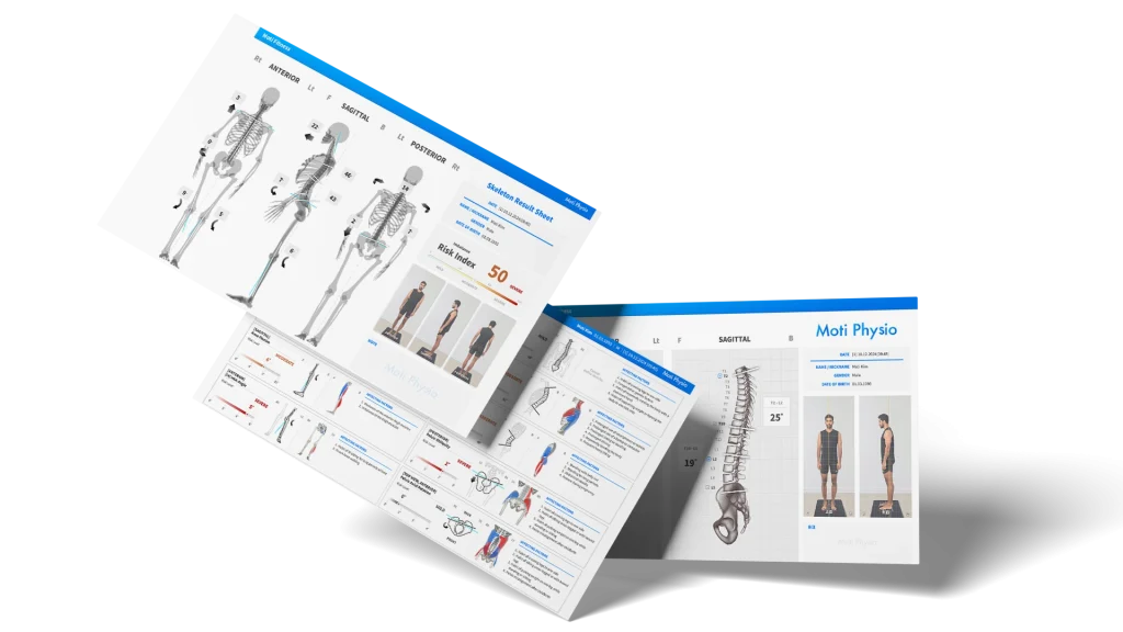 Moti Physio Bratislava | Fyziodiagnostika KinetiQ