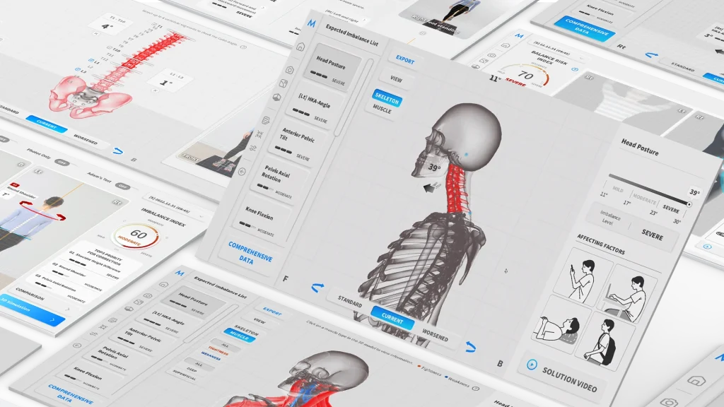 Moti Physio Bratislava | Fyziodiagnostika KinetiQ
